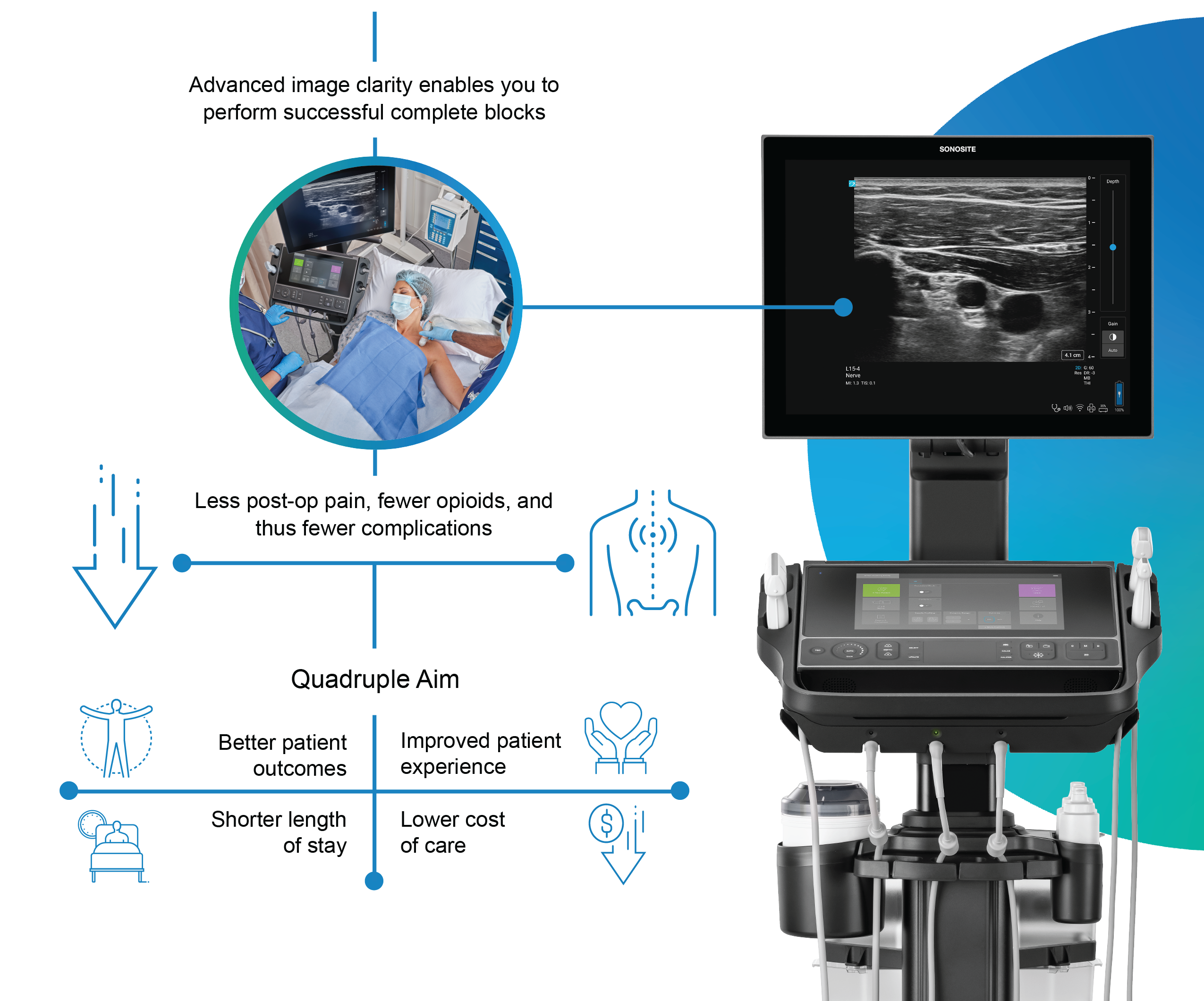 It's about clarity. | Sonosite